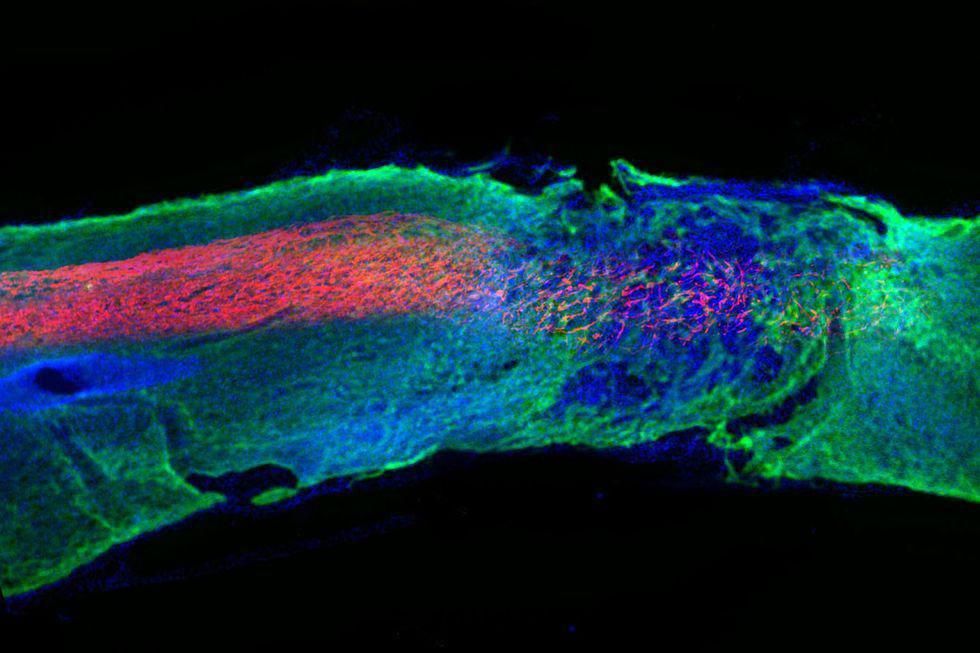 Mouse Study Points to Possible Breakthrough Against Spinal Cord Injury ...