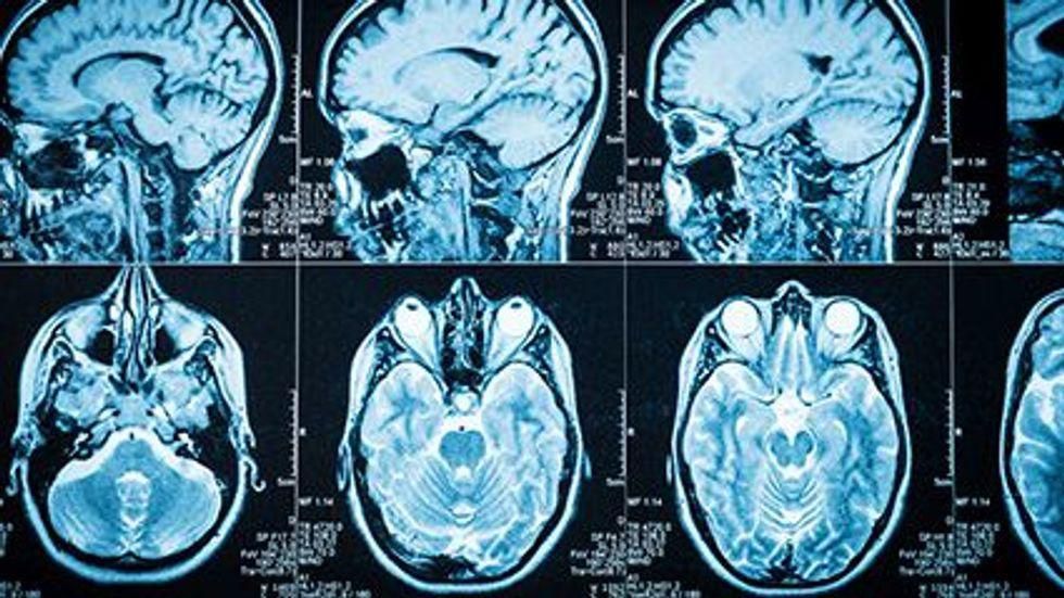 New Treatment Greatly Boosts Survival for Kids With Aggressive Brain ...